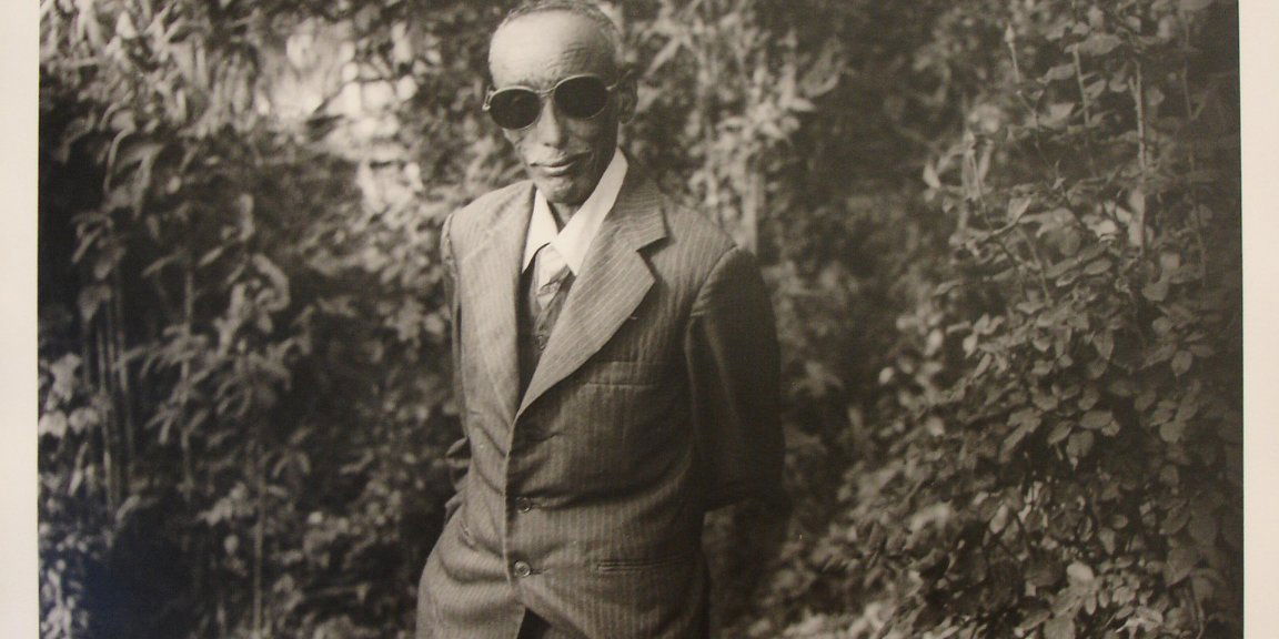 Mr. Andarge, a Teacher in Ethiopia Who Once Had Hansen’s Disease ...